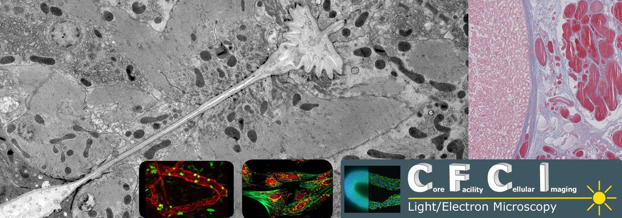 Core Facility Cellular Imaging — CFCI - Core Facility Cellular Imaging — TU Dresden